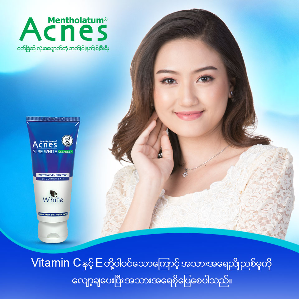 ACNES PURE WHITE WASH 100G (3S Formula) | Shop.com.mm