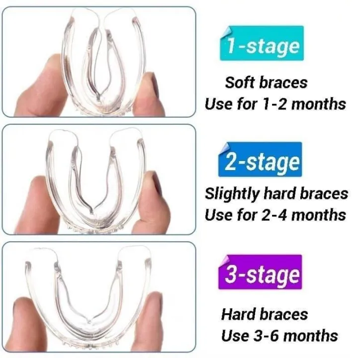 (A3, third stage, hard braces)Teeth retainer dental health care brace ...